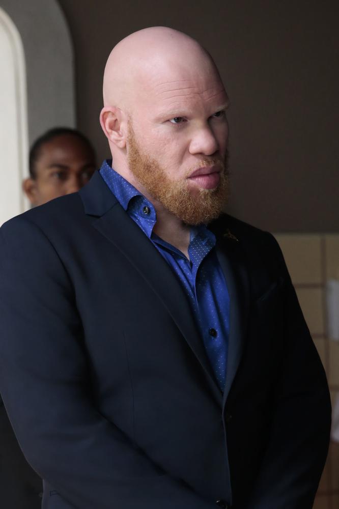 Albino African Actor